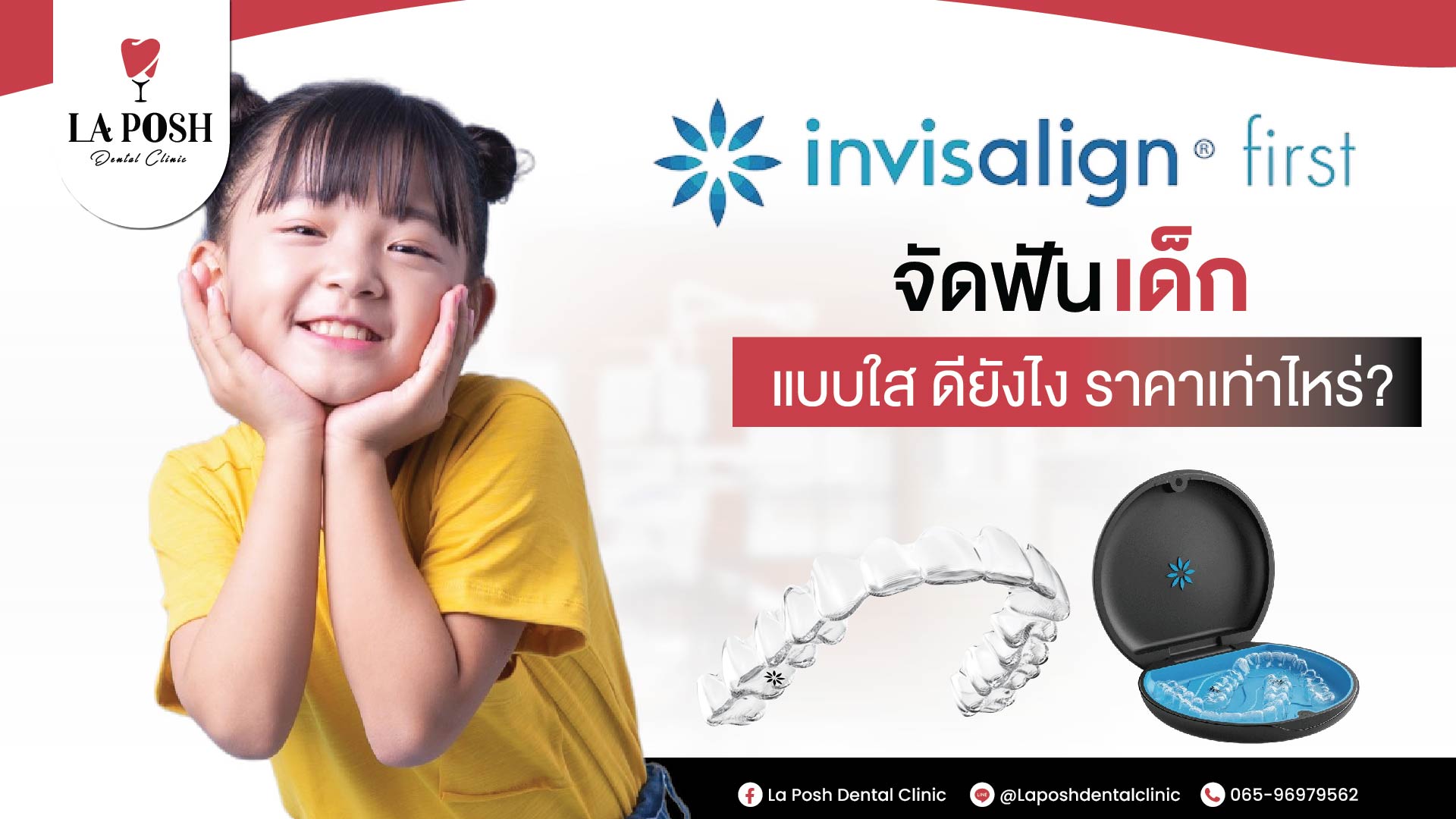 จัดฟันเด็กแบบใส Invisalign First - La Posh Dental Clinic