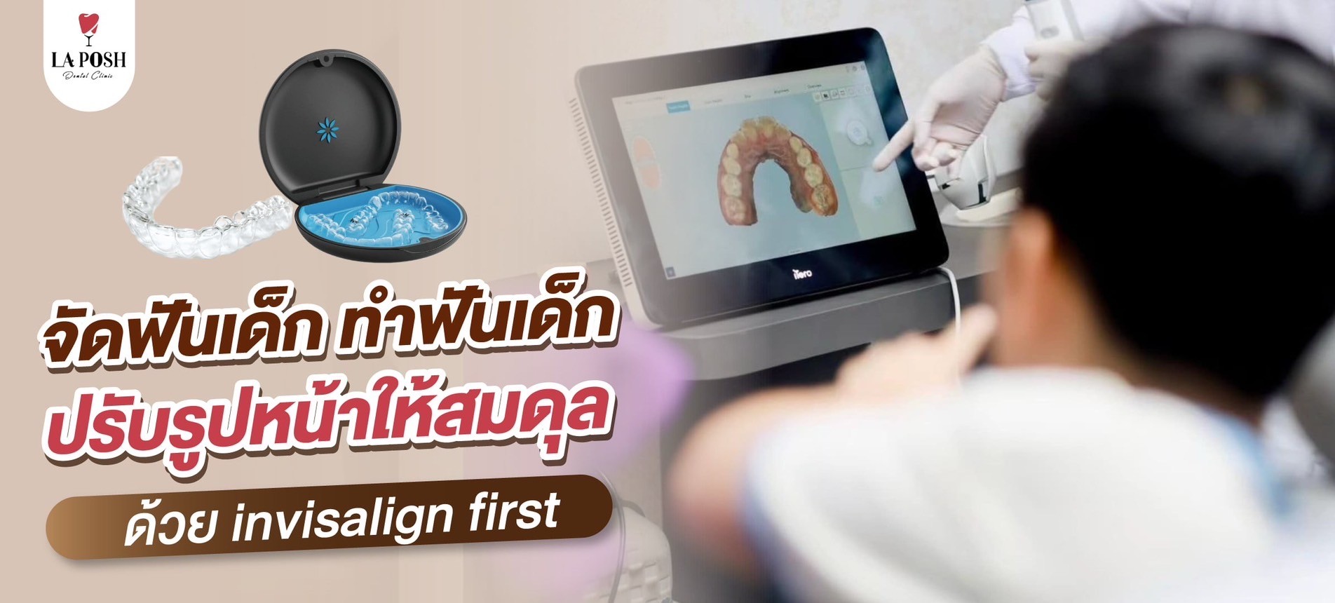 invisalign First - La Posh Dental Clinic